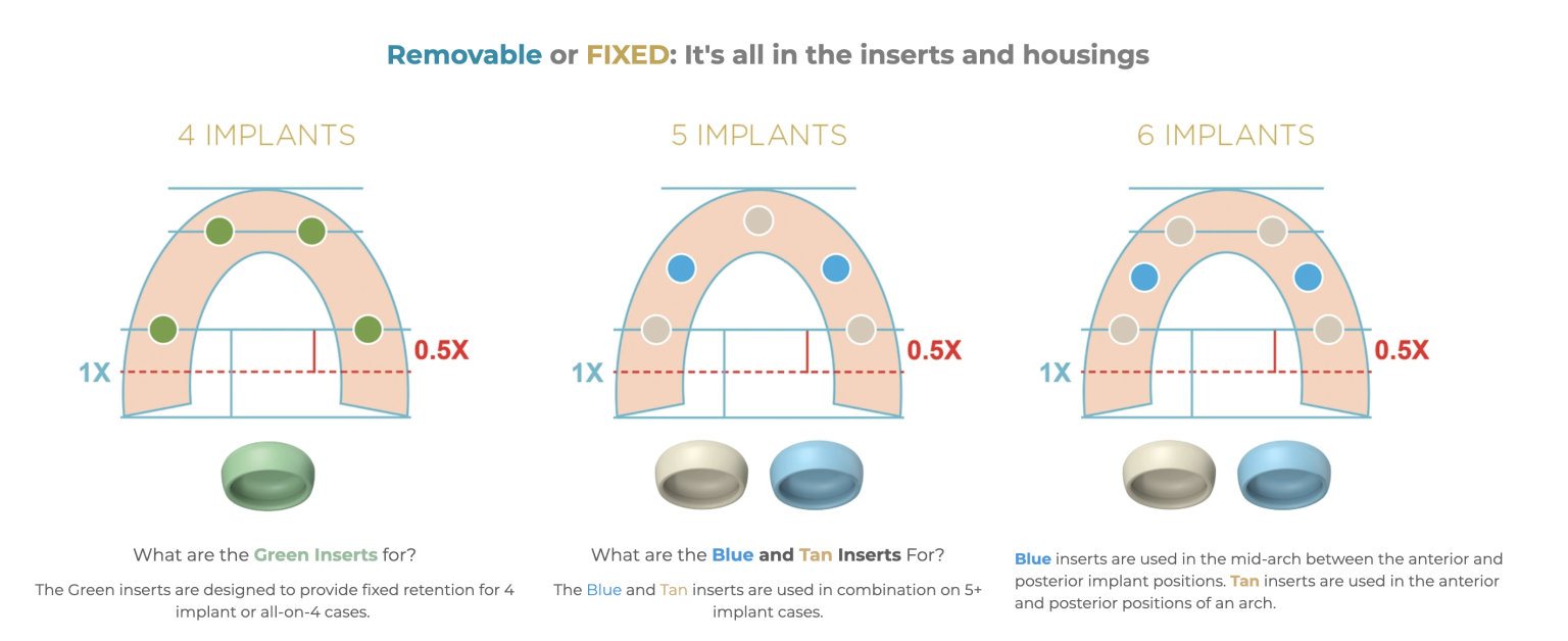 7 Inspiring Ways Locator Fixed Elevates Full-Arch Treatment