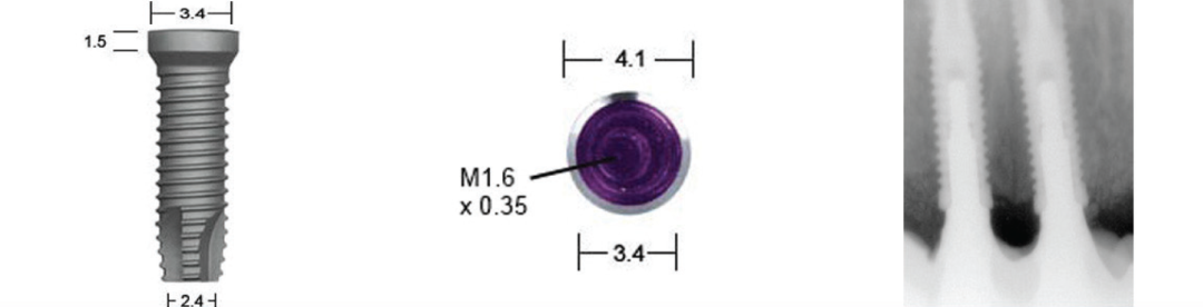 Biomet 3i - Swiss NF Metals